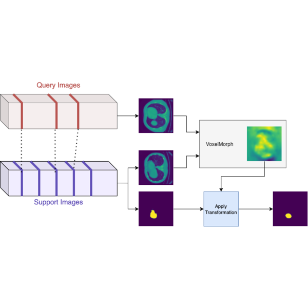 Few-Shot Medical Image Segmentation | Sadegh Mahdavi